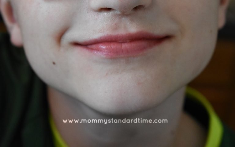 THE ULTIMATE SKIN STAIN REMOVER - Mommy Standard Time