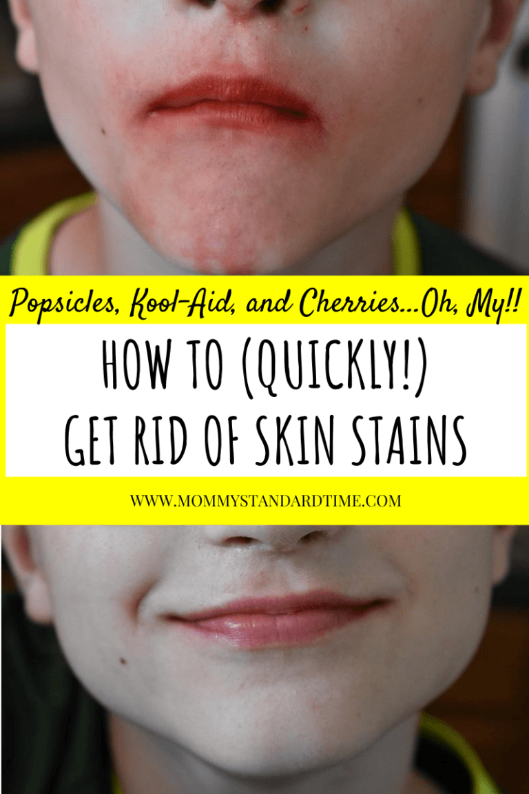 How to Quickly Get Rid of Skin Stains - Mommy Standard Time